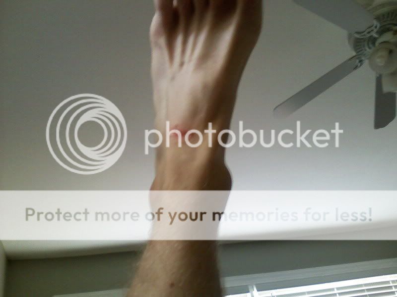 Cut Foot Pictures, Images & Photos | Photobucket